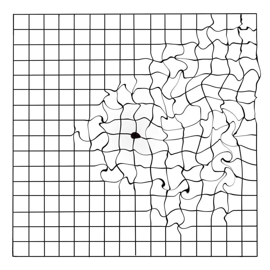 Maculapucker - Eyescan